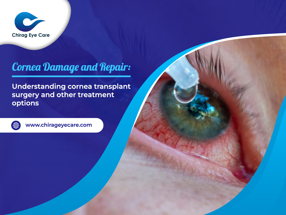 Cornea Damage & Repair- Understand The Cornea Transplant Surgery